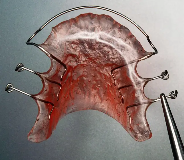 Tie Dye Retainer Designs