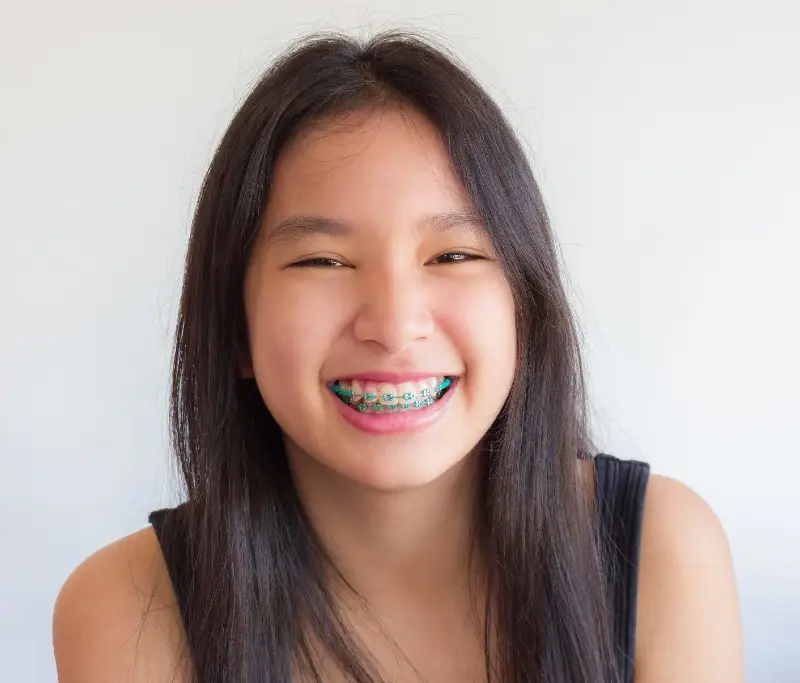 Affordable, Quality Braces for Kids & Adults - Smiles, Simple!